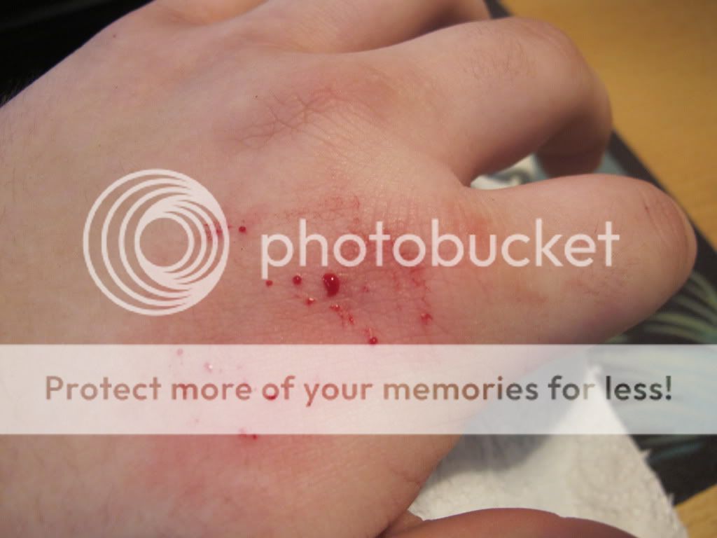 Carpet python bite | Reptile Forums